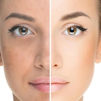 Produits pour Peau Terne : The Ordinary, K-Beauty & Plus - FREYA Tunisie