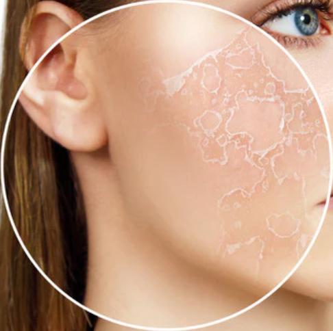 Produits pour Peau Sèche - The Ordinary, K-Beauty & Plus - FREYA Tunisie