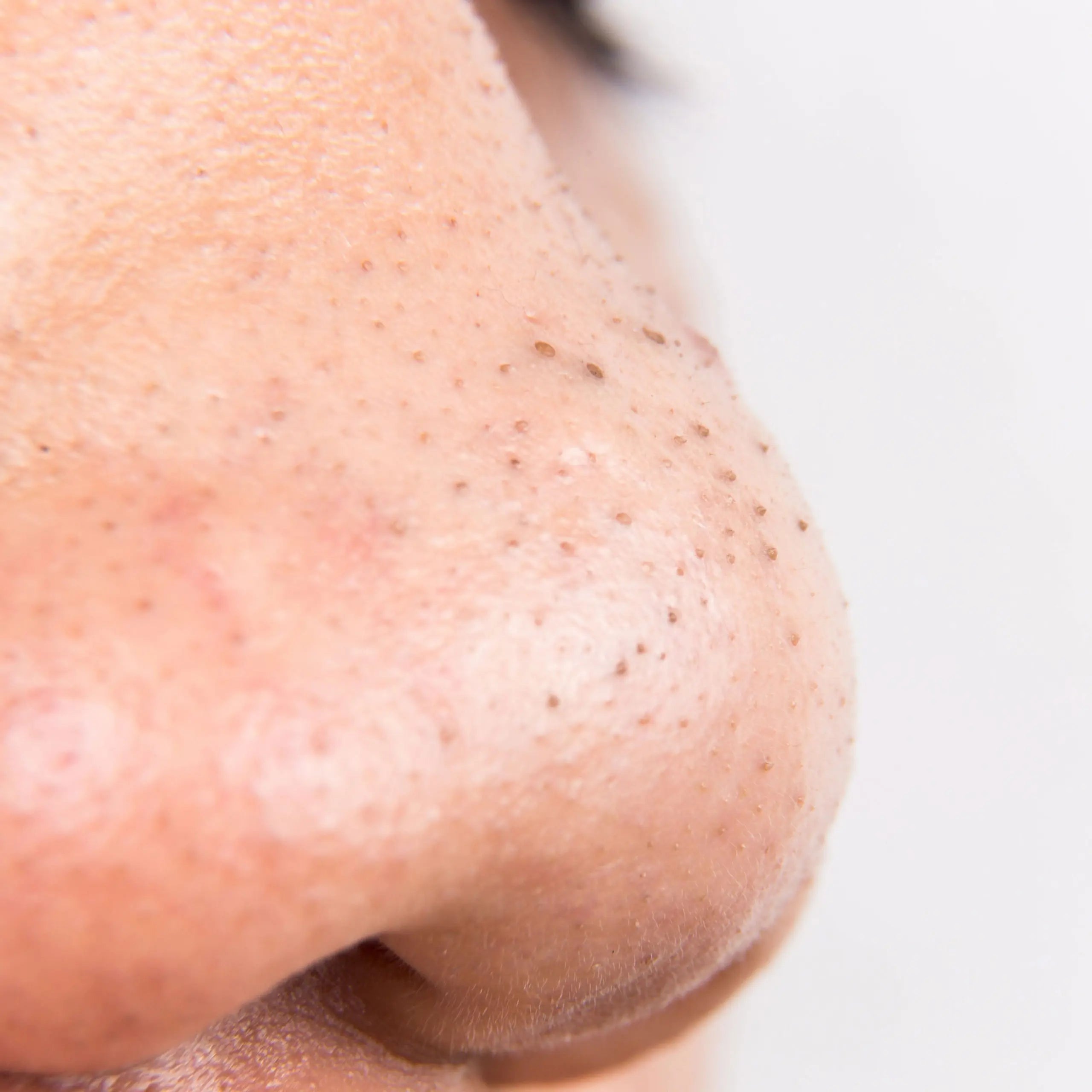 Produits Anti Points Noirs : The Ordinary, K-Beauty & Plus - FREYA Tunisie